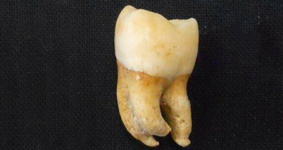 Dental News - Researchers discover method to control tooth root development